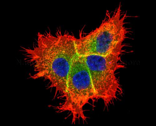 PRESS RELEASE Report